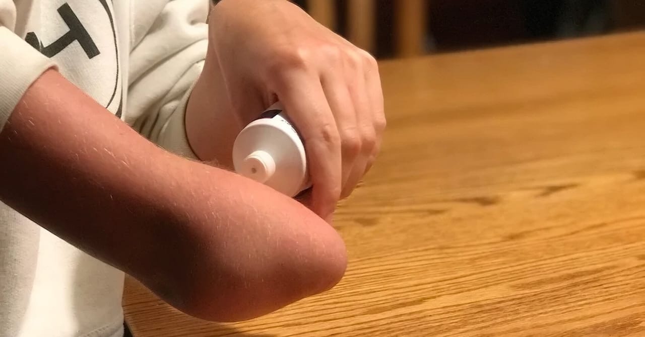 Living with a Prosthetic: Daily Care & Maintenance