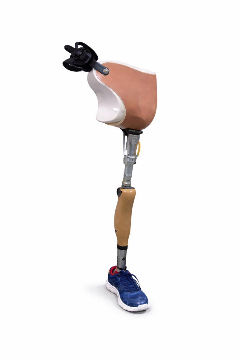 Different Types of Prosthetic Legs and Arms – Explained Simply